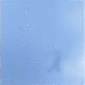 How can you prevent eye floaters? | Optimax